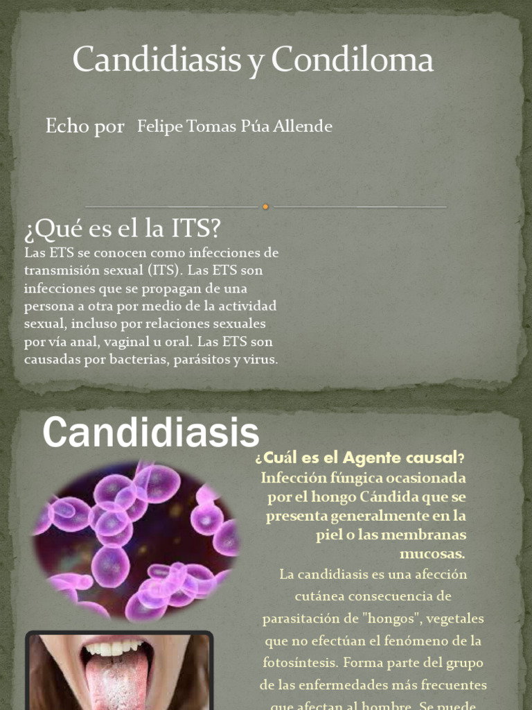 Candidiasis y Condiloma: Guía Rápida | PDF | Candidiasis | Infección ...