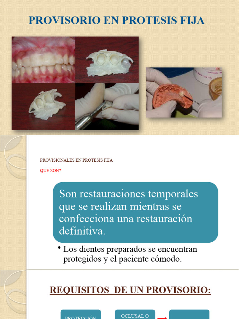 Tema 5 Provisionales en Protesis Fija | PDF | Anatomia dental | Ramas ...