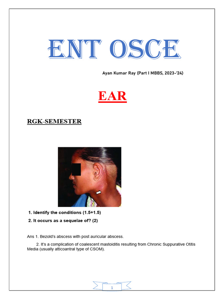 Revised ENT OSCE (MB) | PDF | Human Nose | Ear