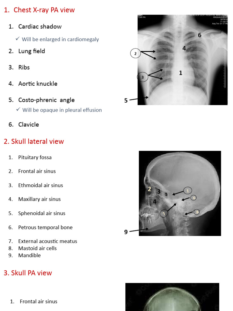 X-ray Views: Chest, Skull, Cervical Analysis | PDF | Vertebra | Human ...