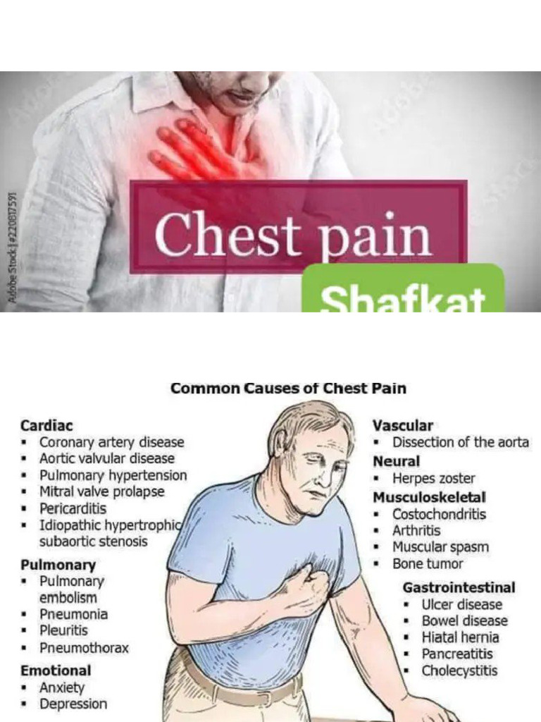 Chest Pain | PDF