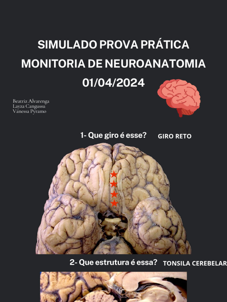 Simulado 1 Neuro | PDF
