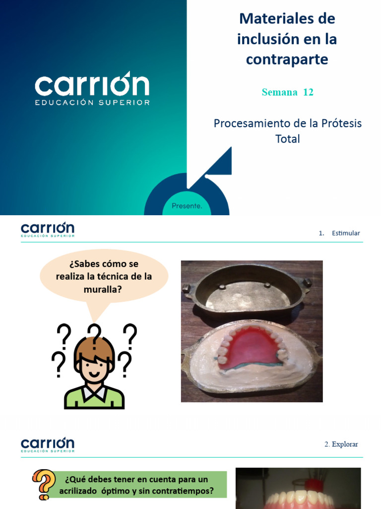 PSA12 PD II Procesamiento de La Protesis Total | PDF | Yeso | Materiales