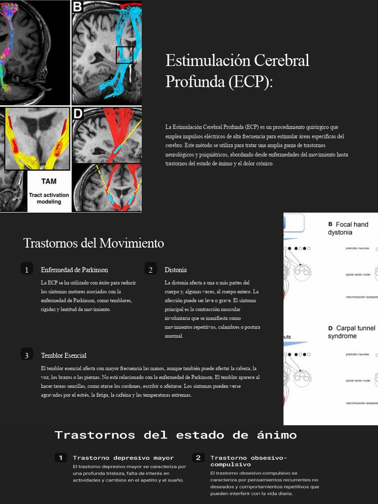 Estimulacion Cerebral Profunda ECP | PDF | Distonia | Enfermedad de Parkinson