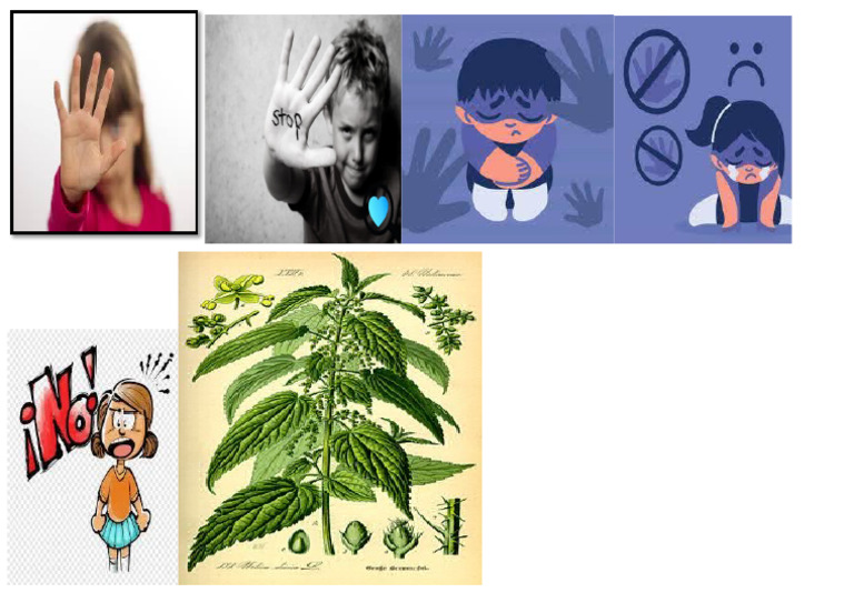 Anatomia Ortiga 2 | PDF