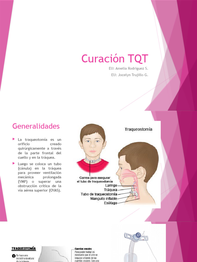 Curacion TQT | PDF | Medicina | Enfermedades y trastornos