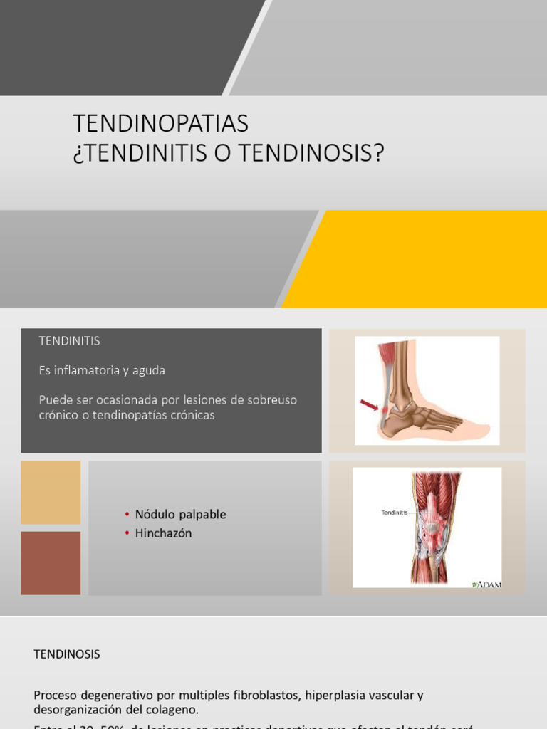 Tendinopatias Capitulo 3 | PDF | Inflamación | Tendón