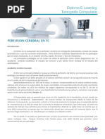 Escala ASPECTS | PDF