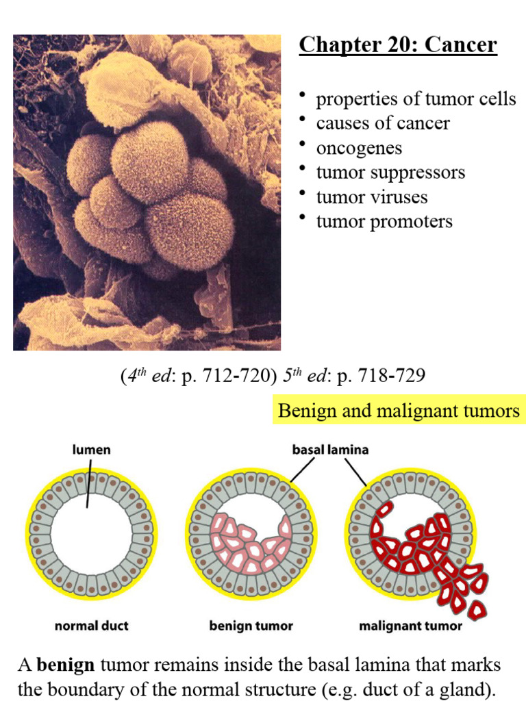 18 Chapt 20 Cancer | PDF | Carcinogenesis | Oncogene