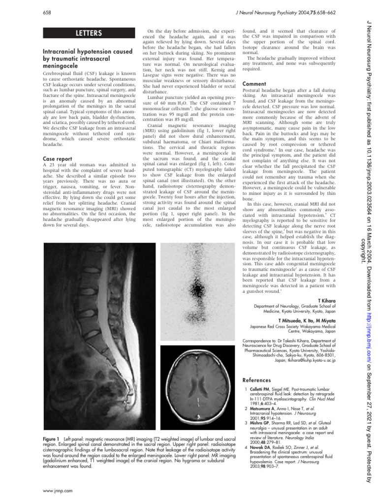 660.full | PDF | Stroke | Cerebrospinal Fluid