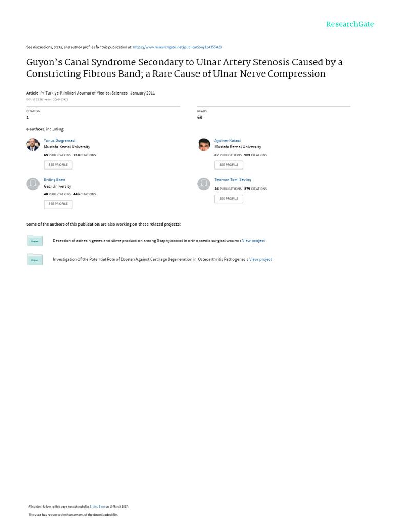 Guyons Canal Syndrome Secondary To Ulnar Artery S | Download Free PDF ...