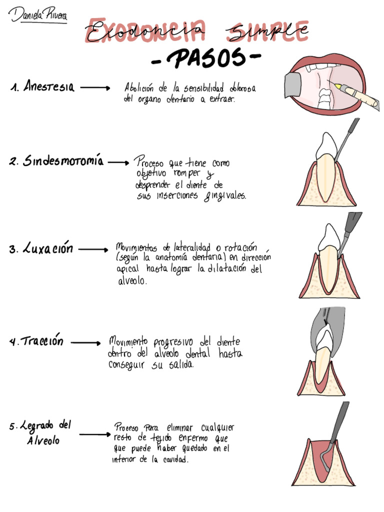 Pasos exodoncia simple | PDF