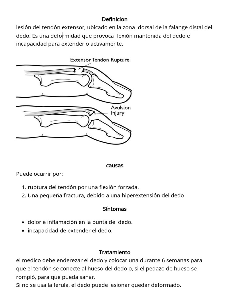 dedo en martillo | PDF