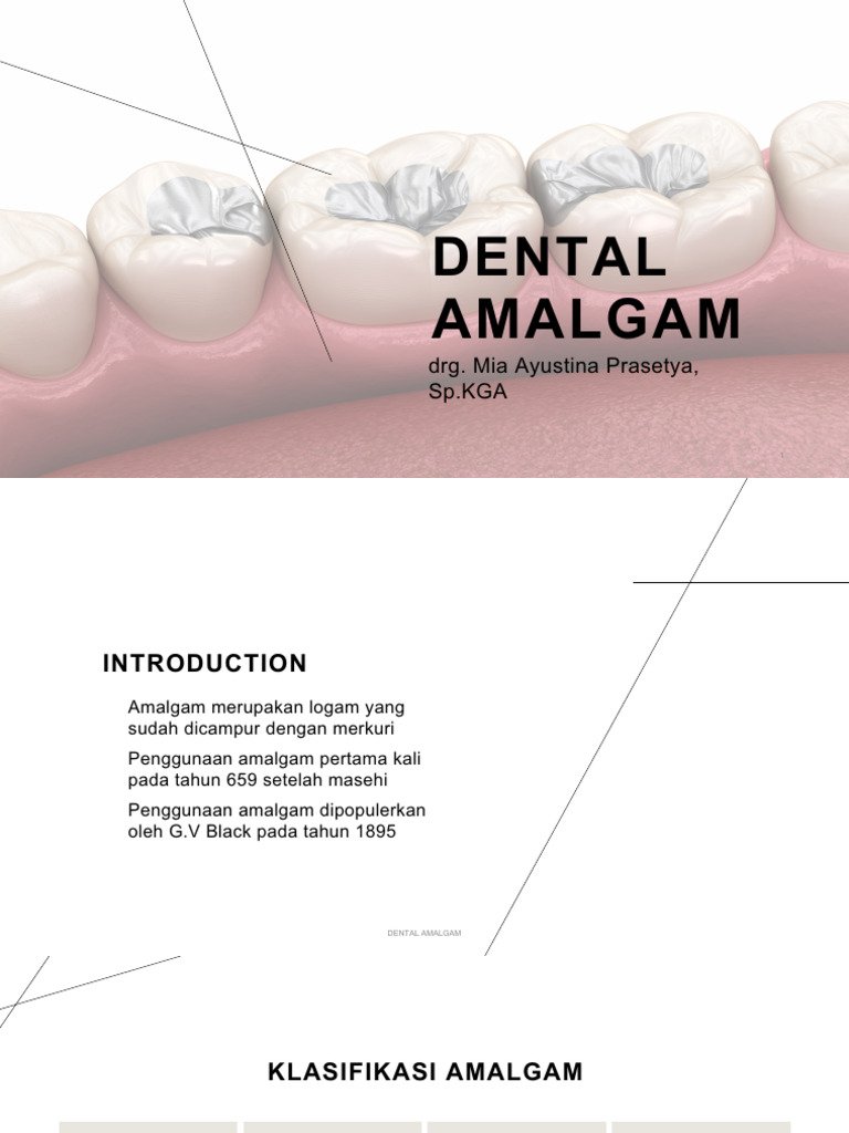 Dental Amalgam | PDF