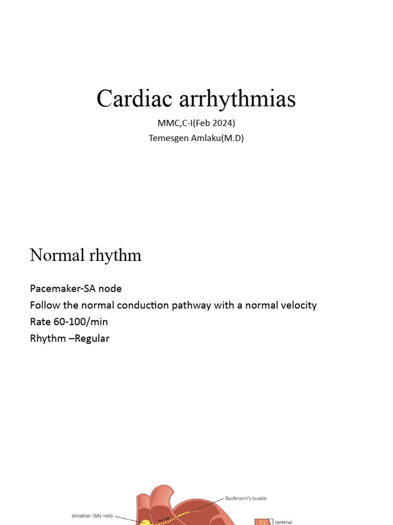 Cardiac Arrhythmias | PDF | Heart | Cardiovascular Physiology