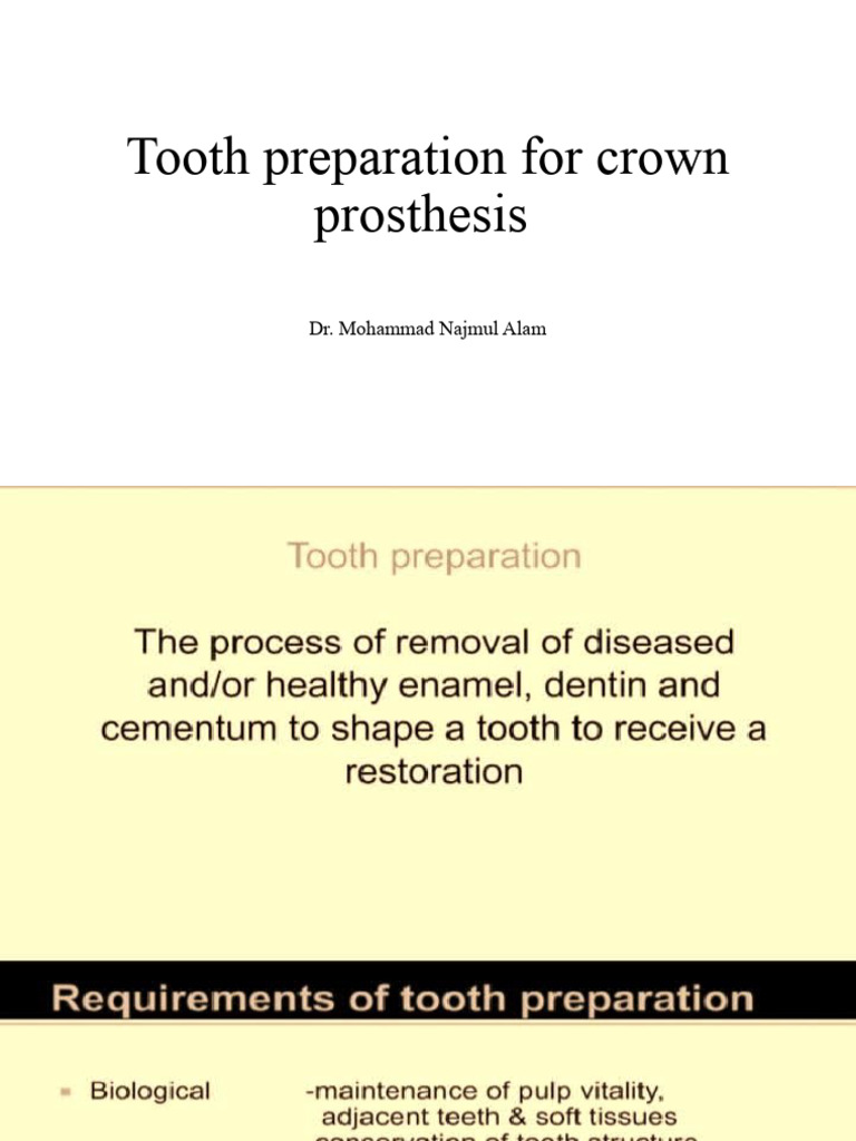 Tooth Preparation For Crown Prosthesis: Dr. Mohammad Najmul Alam | PDF
