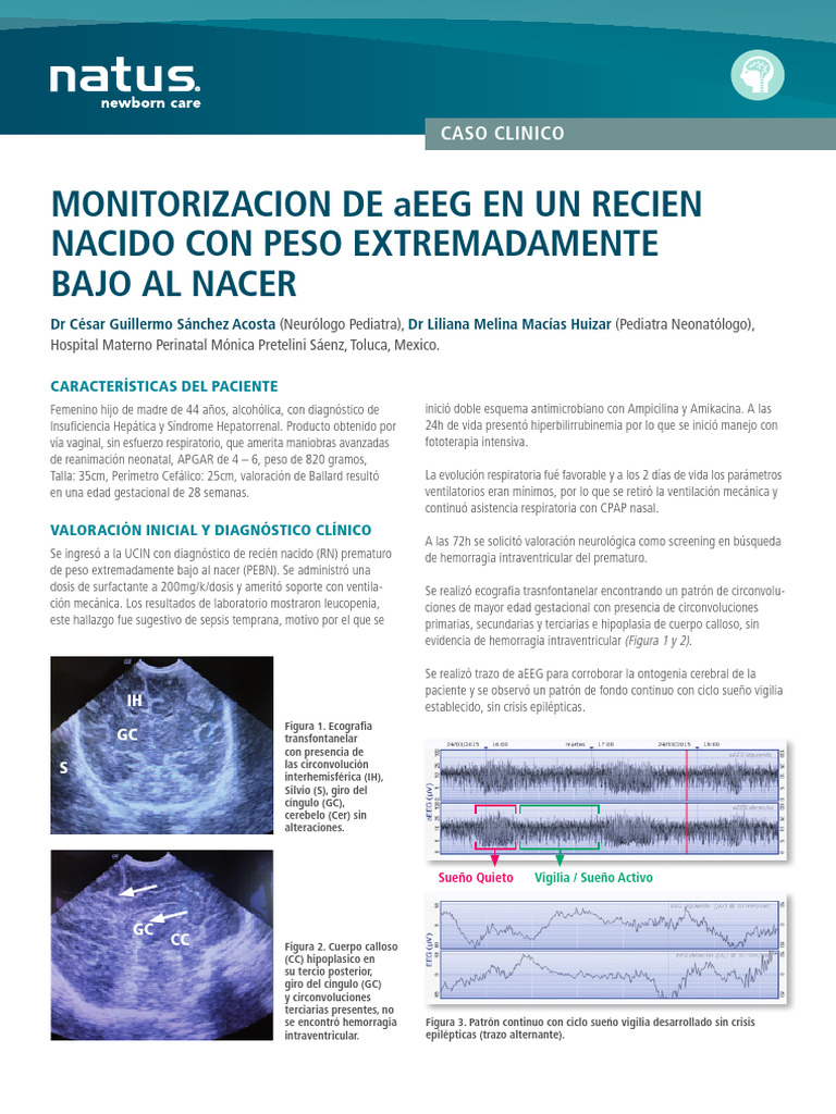 021440A_aEEG Monitoring Low Birth Weight Case Study_ES A4_lo-res | PDF ...