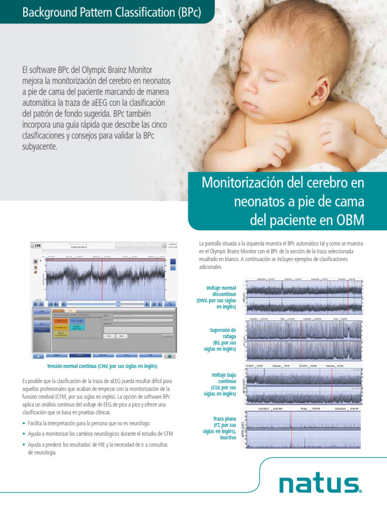 029349D CFM Olympic Brainz Monitor BPC Datasheet - SP - Low Res | PDF ...