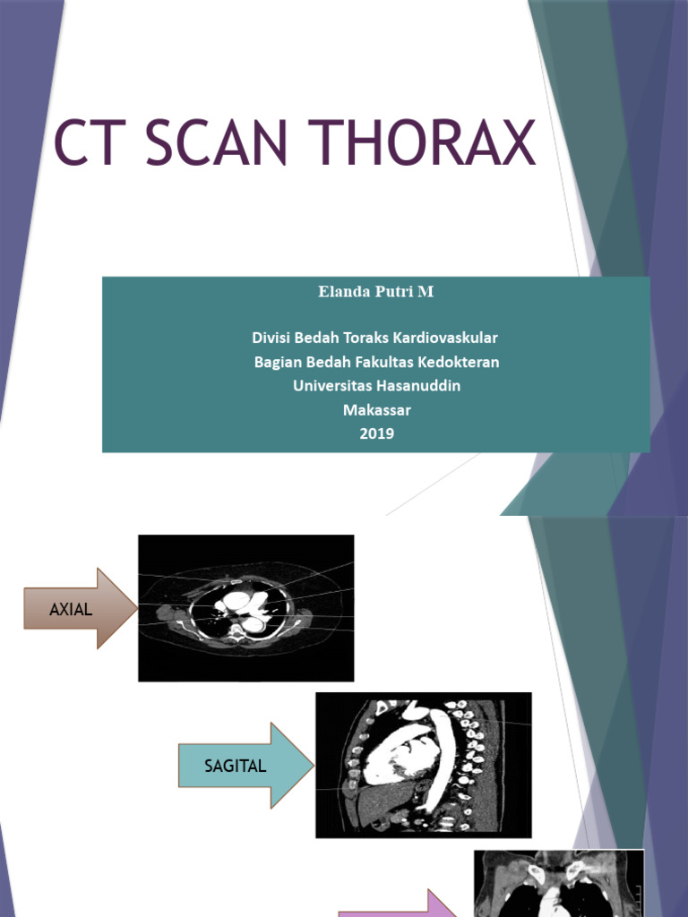 CT Scan Thoraks Elanda | PDF