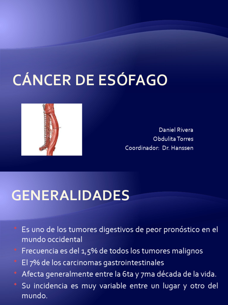 12 - Cáncer de Esófago | PDF | Terapia | Metástasis