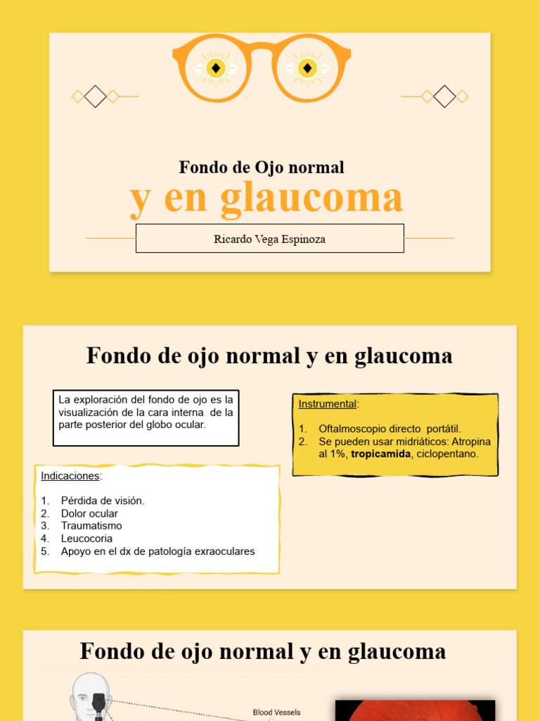 Fondo de ojo normal y en glaucoma | PDF