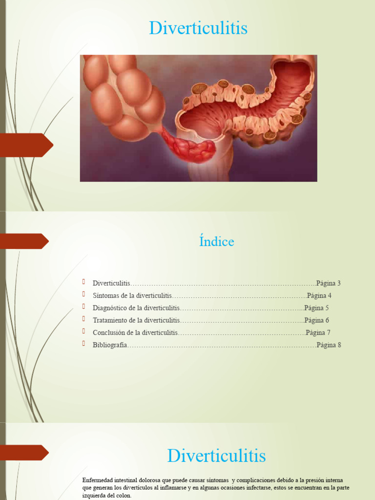 Guía sobre la diverticulitis y su tratamiento | PDF | Salud y bienestar