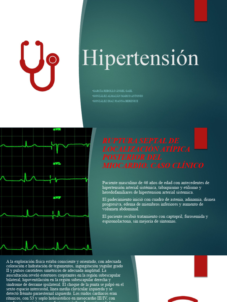 Borra Dor | PDF | Infarto de miocardio | Electrocardiografia