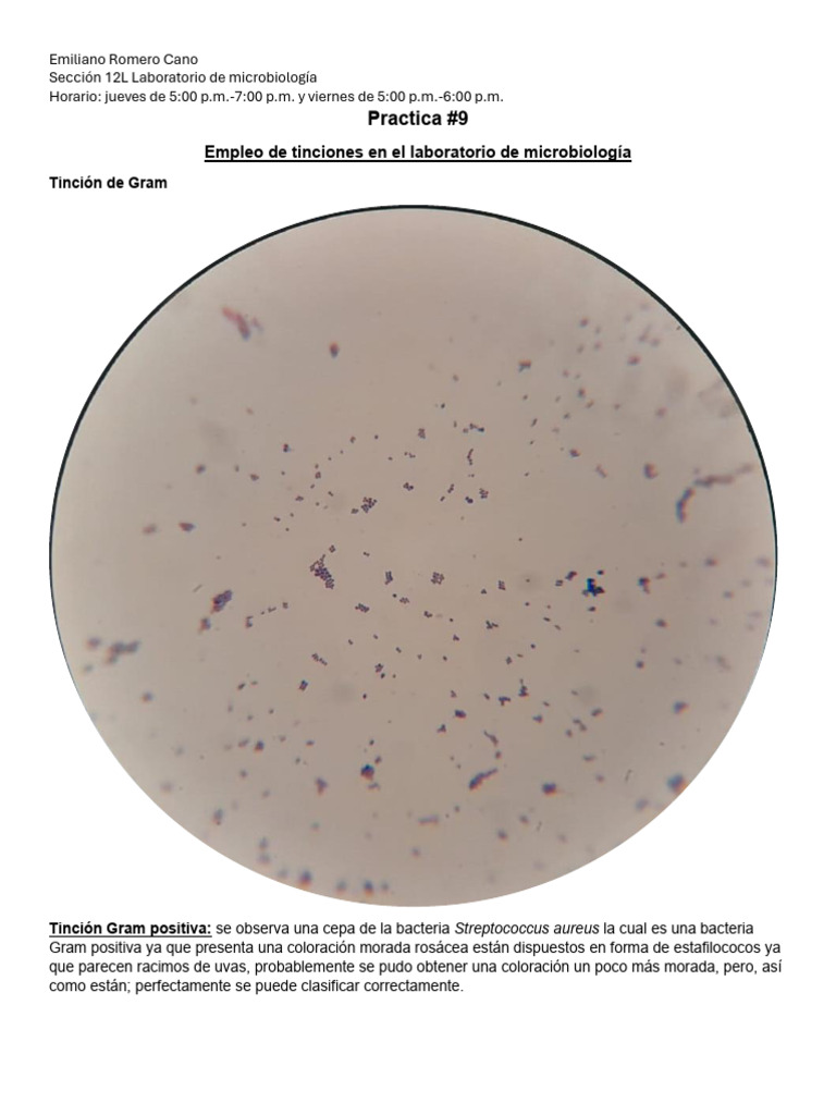 Tinciones Microbiológicas en Laboratorio | PDF | Tinción | Las bacterias