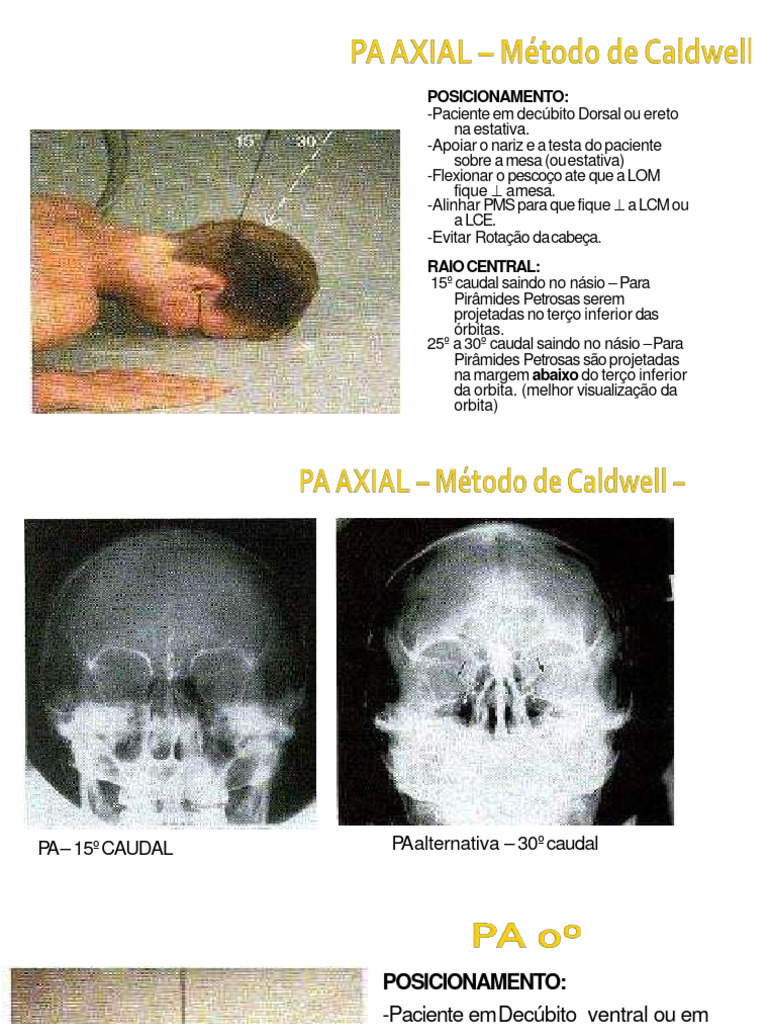 Anatomia Radiologica Do Crânio 2 | Download grátis PDF | Sistema ...