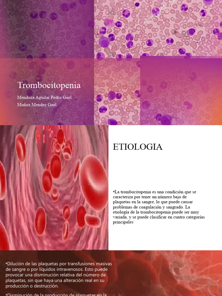 Trombocitopenia | PDF | Sangre | Plaqueta