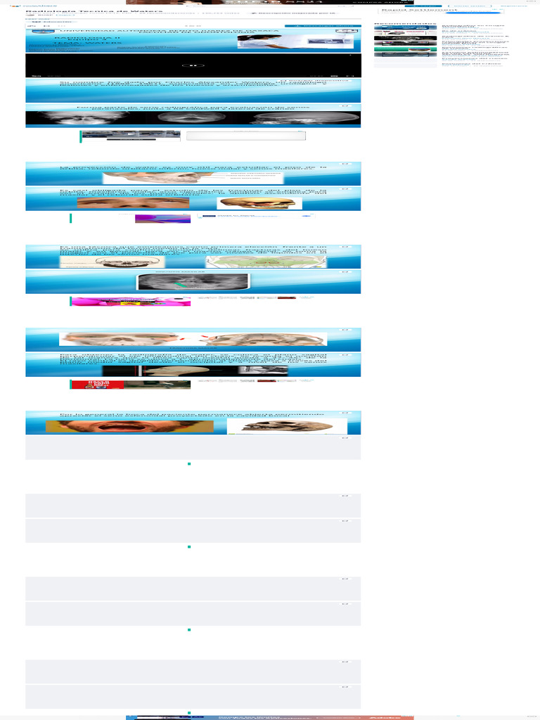 Radiología Tecnica de Waters | PDF | Imagen | Radiología