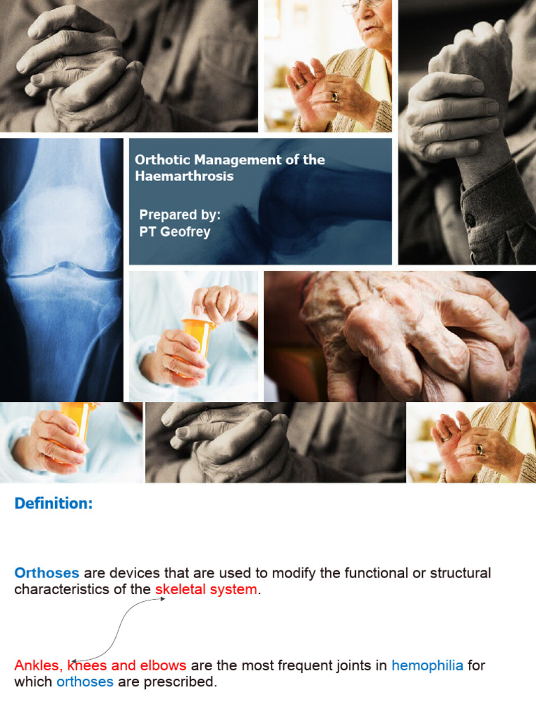 Orthotic Management for Haemarthrosis | PDF | Musculoskeletal System | Foot