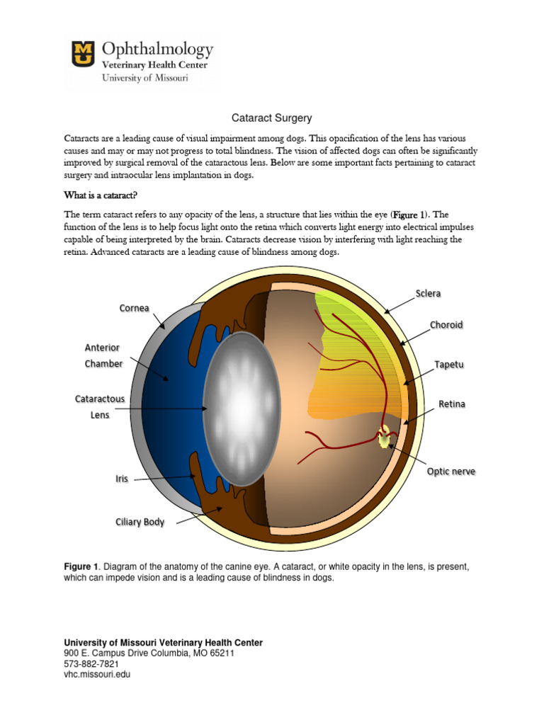 Cataract Surgery | PDF | Cataract | Surgery