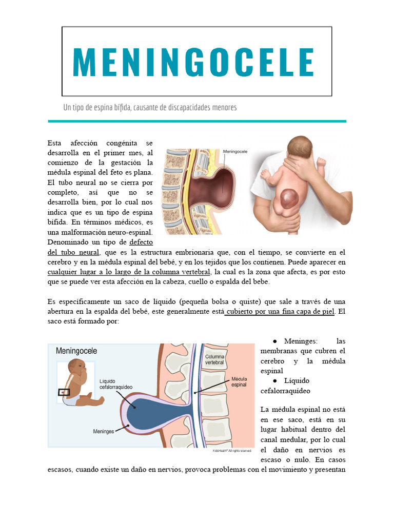 Resumen, Meningocele | PDF | Especialidades Medicas | Sistema nervioso