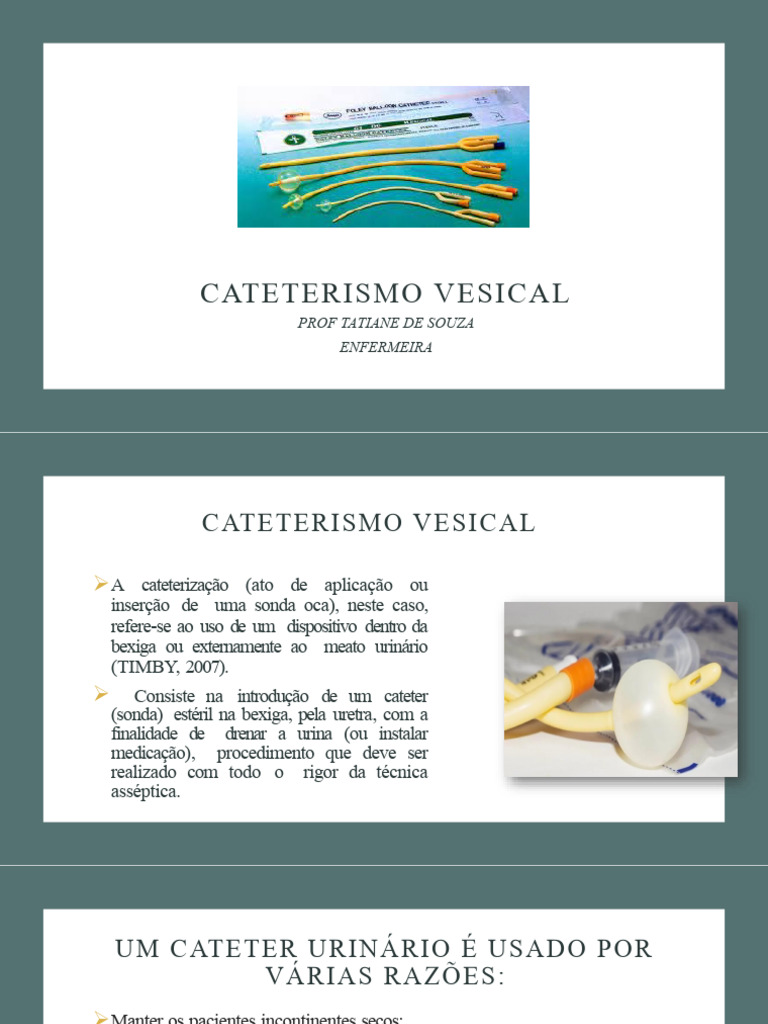 AULA 17 CATETERISMO VESICAL | PDF | Micção | Próstata