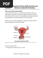 Coding For Inserting and Removing Iuds | PDF