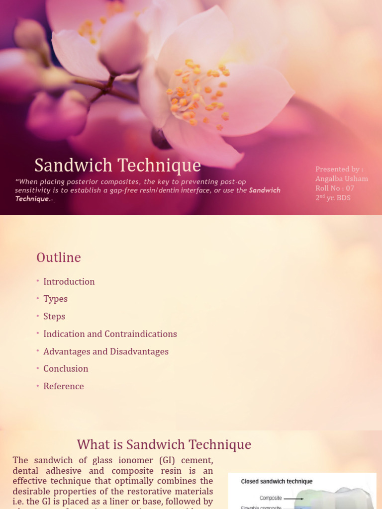 Sandwich Technique | PDF | Dental Composite | Tooth Enamel
