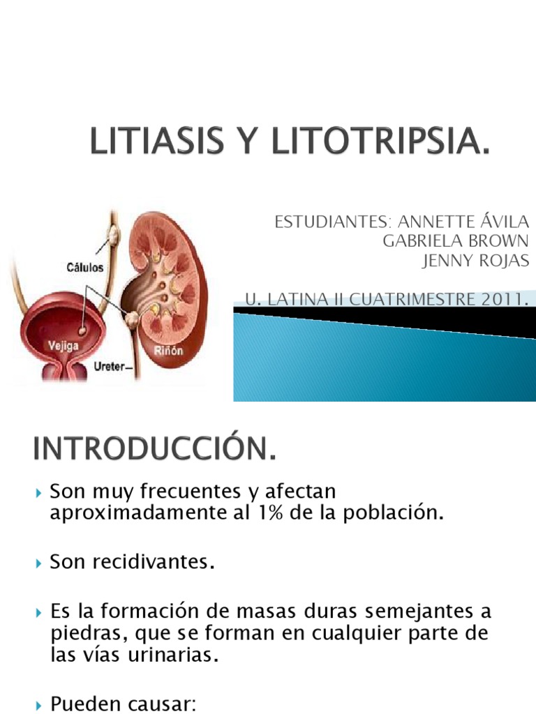 Litiasis y Litotripsia Presentacion | Riñón | Medicina CLINICA