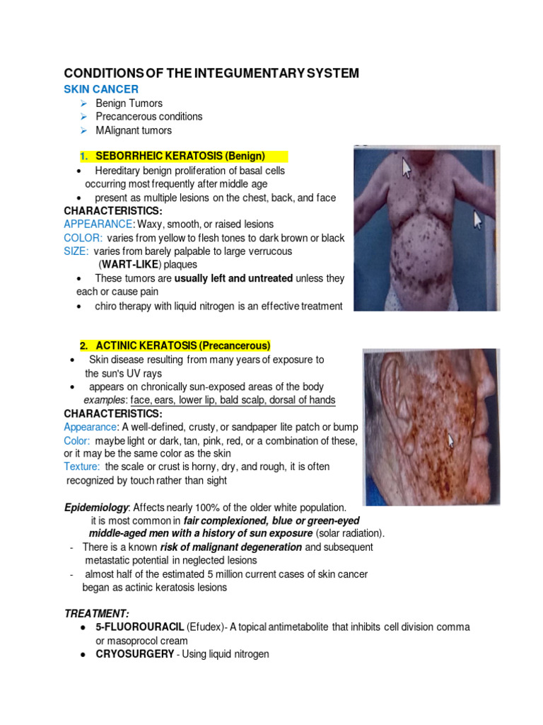 Skin Cancer Types and Treatments Guide | PDF | Melanoma | Dermatitis