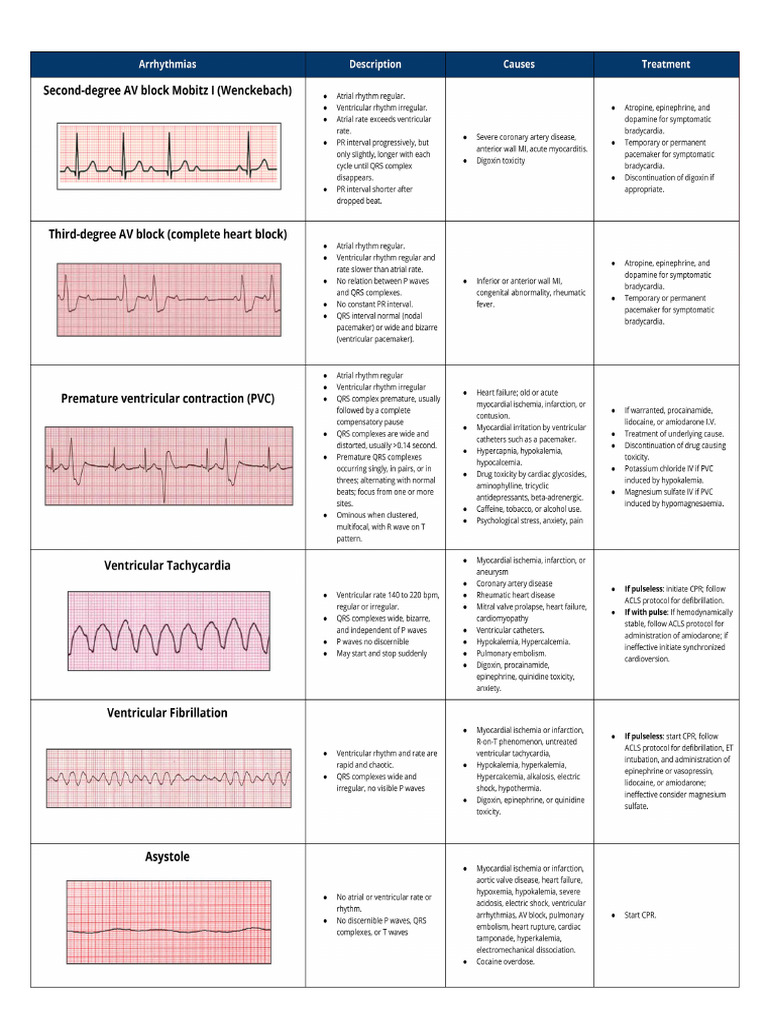 ECG | PDF