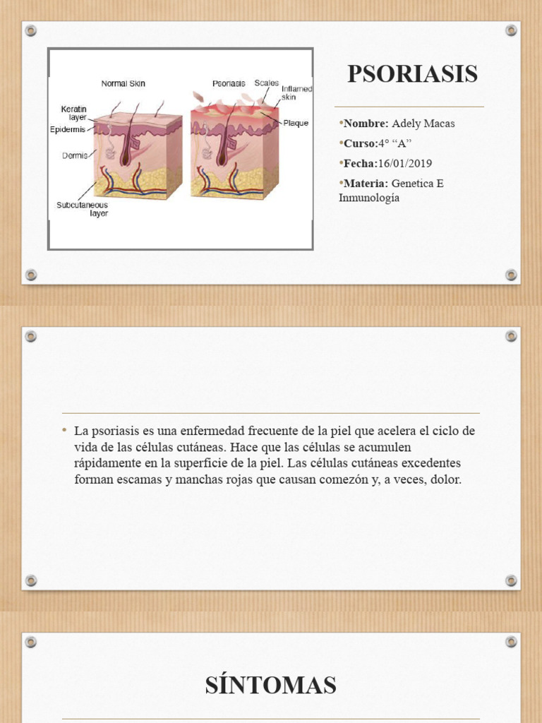 psoriasis | PDF | Psoriasis | Piel