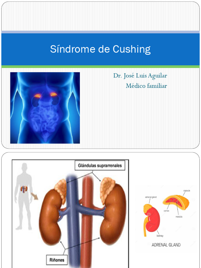 Síndrome de Cushing - SD Addison | PDF | Glándula suprarrenal | Cortisol