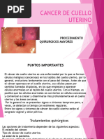 Técnica Quirúrgica de Cesárea Pfannenstiel | PDF | Cirugía | Abdomen