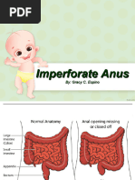 Types of Incision | PDF | Abdomen | Surgery