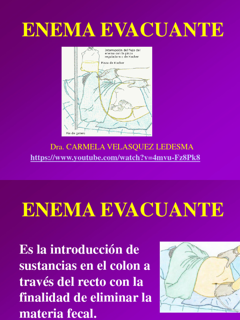 Tema 15 Enema Evacuante | PDF | Cáncer colonrectal | Hemorroides