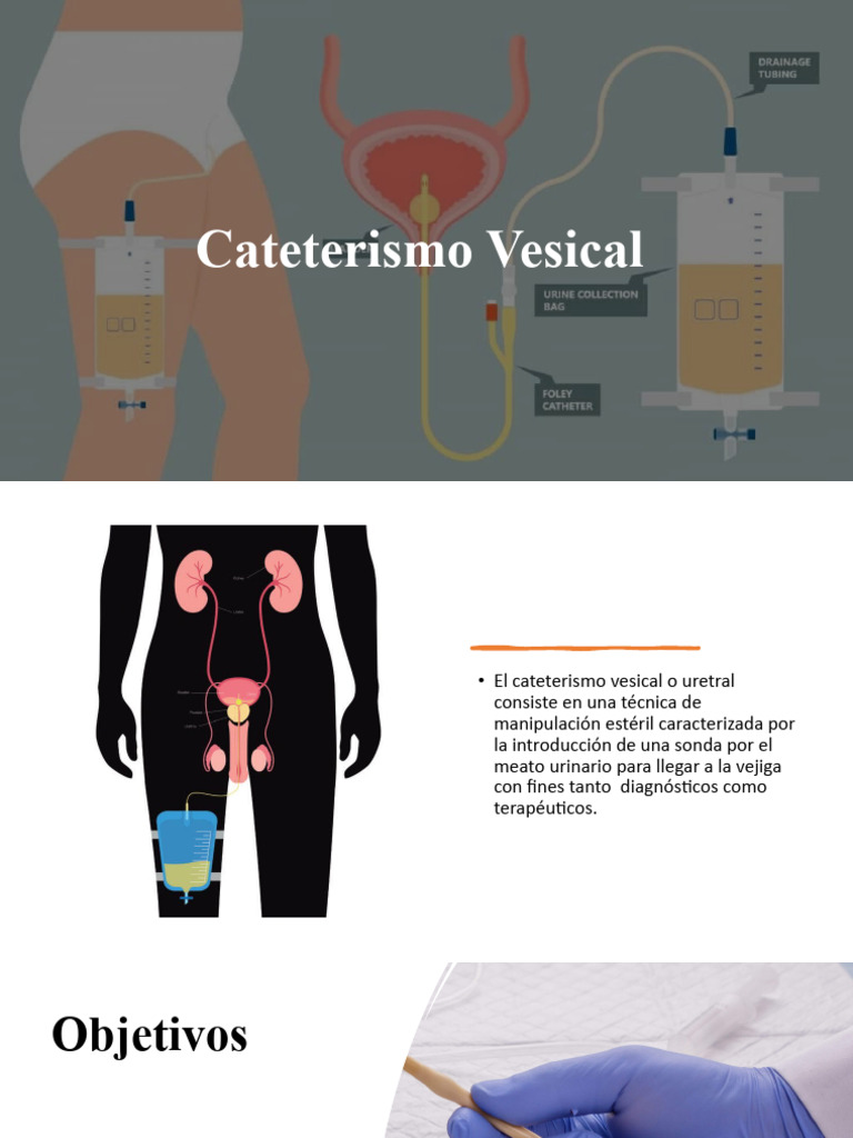 Cateterismo Vesical | PDF | Sistema urinario | Sistema genitourinario