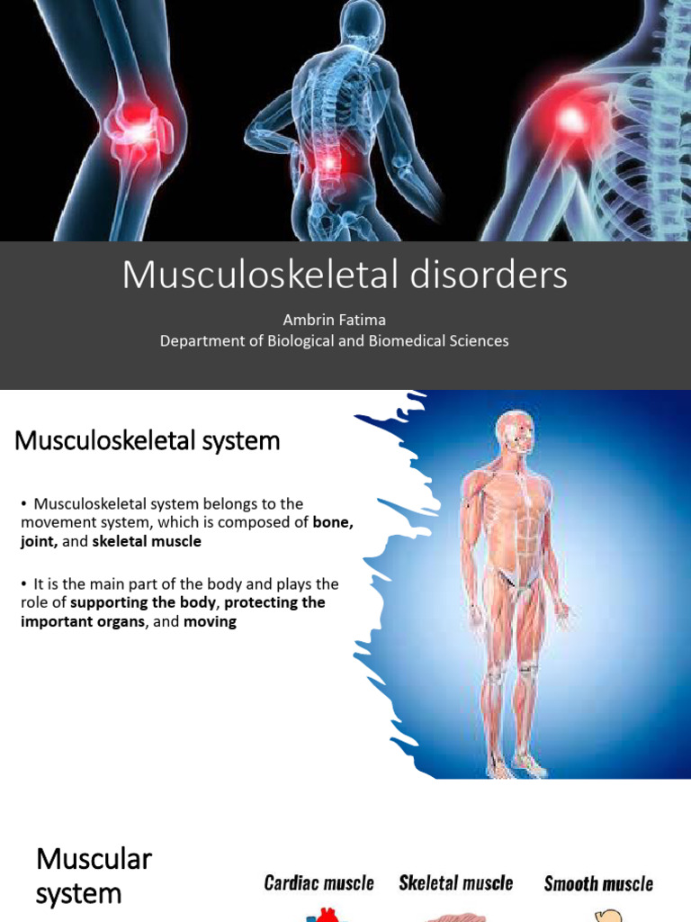 Understanding Musculoskeletal Disorders | PDF | Arthritis | Rheumatoid ...
