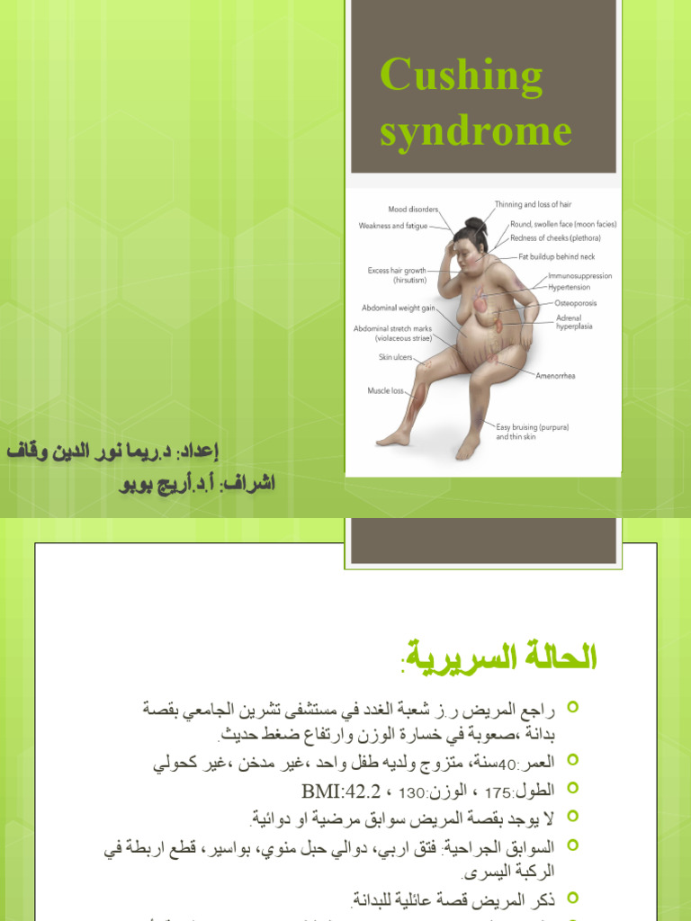 Cushing Syndrome 1 | PDF