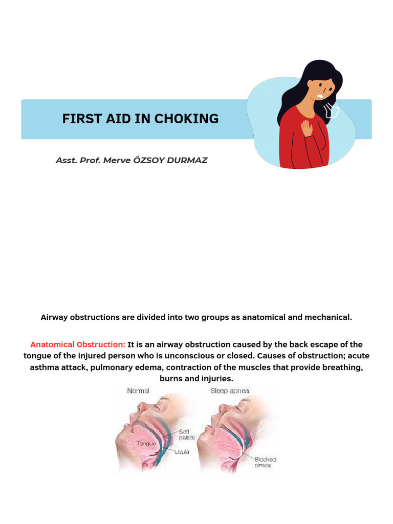 First Aid in Choking | PDF | Clinical Medicine | Medical Specialties