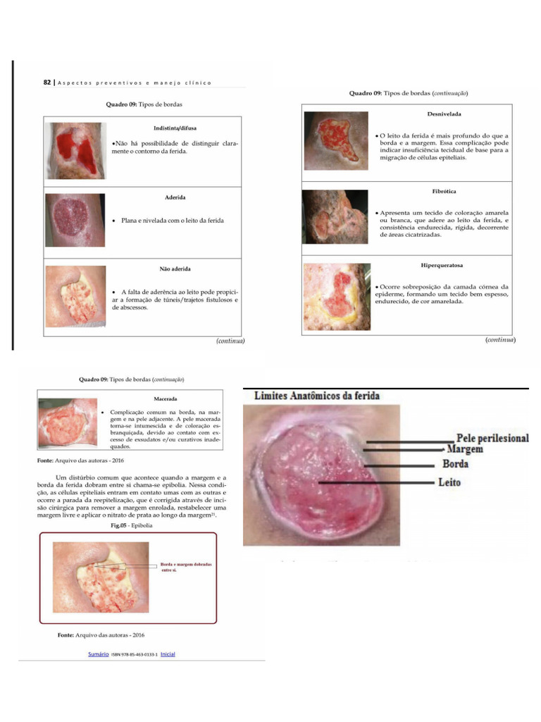 Tipos de Bordas | PDF